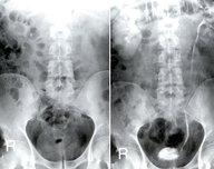 Diagnostic investigations and procedures in urology - Knowledge @ AMBOSS