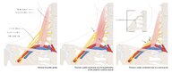 Thoracic outlet syndrome - Knowledge @ AMBOSS