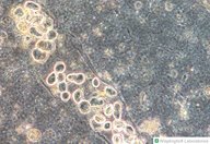 Acute kidney injury - Knowledge @ AMBOSS