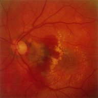 Eye pain and red eye - Knowledge @ AMBOSS