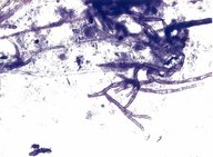 General mycology - Knowledge @ AMBOSS