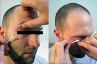 Eye pain and red eye - Knowledge @ AMBOSS