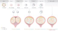 Multifetal gestation - Knowledge @ AMBOSS
