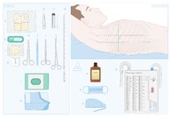 Chest tube placement - Knowledge @ AMBOSS