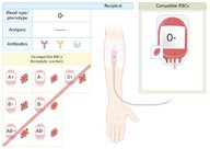 Transfusion - Knowledge @ AMBOSS