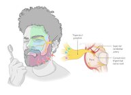 Multiple sclerosis - Knowledge @ AMBOSS
