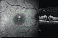 Examination of the eye - Knowledge @ AMBOSS
