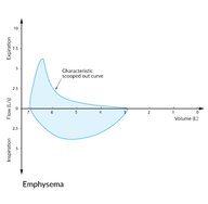 Chronic obstructive pulmonary disease - Knowledge @ AMBOSS