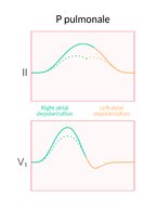 ECG - Knowledge @ AMBOSS