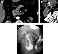 Pancreas - Knowledge @ AMBOSS