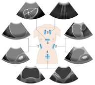 Point-of-care ultrasound - Knowledge @ AMBOSS