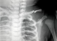 Late-term and postterm pregnancy - Knowledge @ AMBOSS