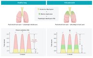 Respiratory physiology - Knowledge @ AMBOSS