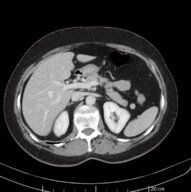 Asplenia - Knowledge @ AMBOSS