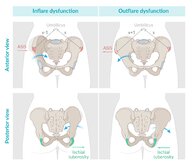 Pelvic and sacral osteopathy - Knowledge @ AMBOSS