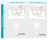 Pelvic and sacral osteopathy - Knowledge @ AMBOSS