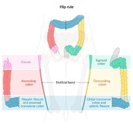 Chapman reflex points - Knowledge @ AMBOSS