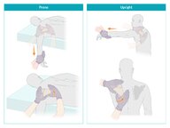 Shoulder reduction - Knowledge @ AMBOSS