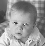 Ocular motility disorders and strabismus - Knowledge @ AMBOSS