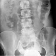 Diagnostic investigations and procedures in urology - Knowledge @ AMBOSS