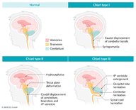 References: [2] [3] [4]