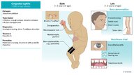Congenital TORCH infections - Knowledge @ AMBOSS