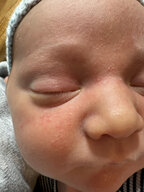 Overview of neonatal conditions - Knowledge @ AMBOSS