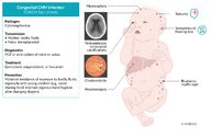 Congenital TORCH infections - Knowledge @ AMBOSS