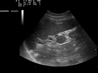 Asplenia - Knowledge @ AMBOSS