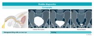 Diagnostic investigations and procedures in urology - Knowledge @ AMBOSS