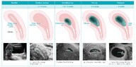 Point-of-care ultrasound - Knowledge @ AMBOSS