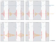 Valvular heart diseases - Knowledge @ AMBOSS