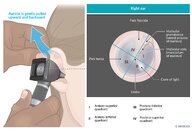 Head and neck examination - Knowledge @ AMBOSS