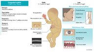 Congenital TORCH infections - Knowledge @ AMBOSS