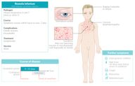 Roseola infantum - Knowledge @ AMBOSS